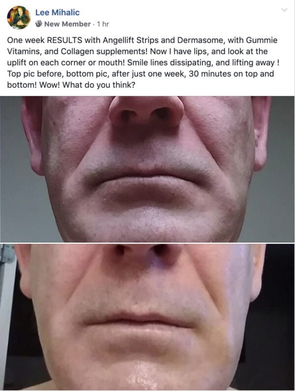 Angel Lift Before and After: Real Customer Transformations and Reviews